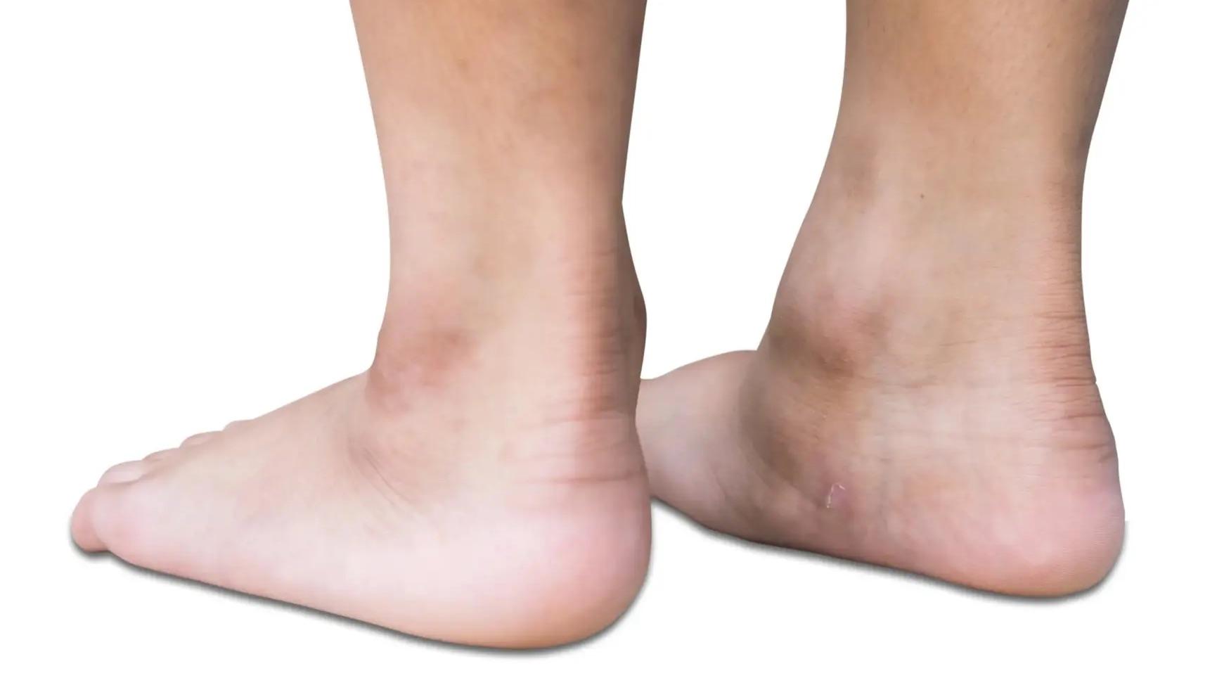 Nikki Kelsall Foot & Ankle Surgeon