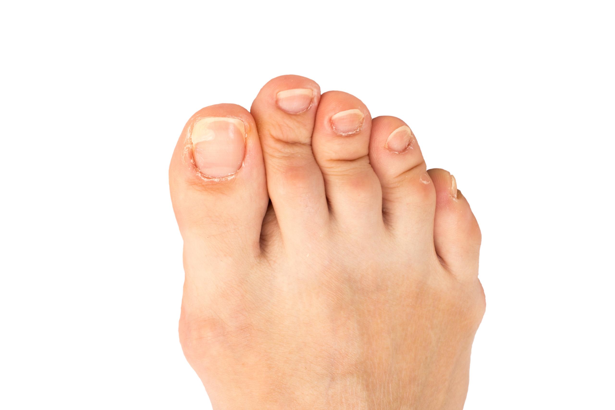 Nikki Kelsall Foot & Ankle Surgeon